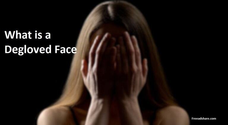 What is a Degloved Face? Understanding the Severe Facial Injury ...